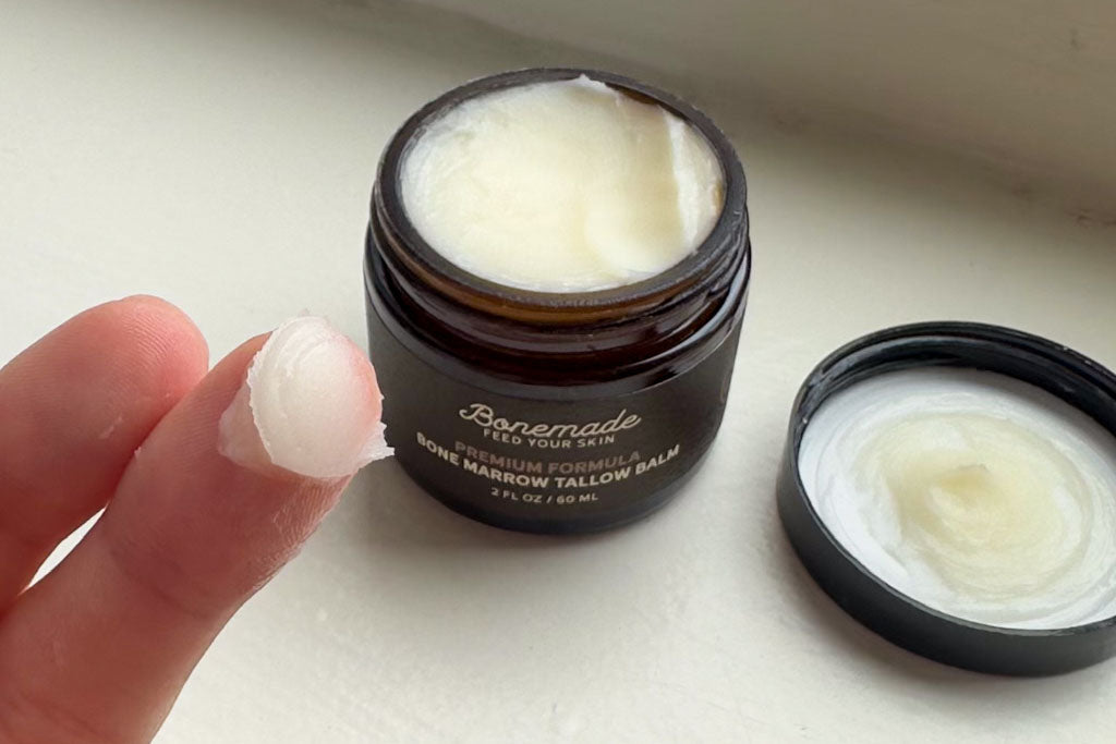 How Beef Tallow Moisturizer Can Help Clear Acne - Bonemade